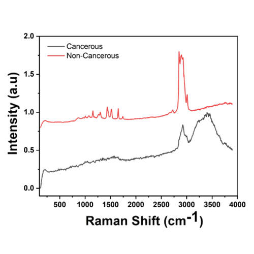 Revolutionizing Cancer Detection: How Raman Spectroscopy is Changing ...